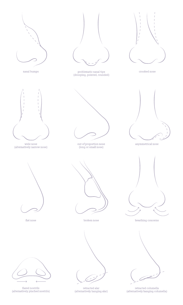 Rhinoplasty Surgery in Melbourne | Nose Job at Me Clinic