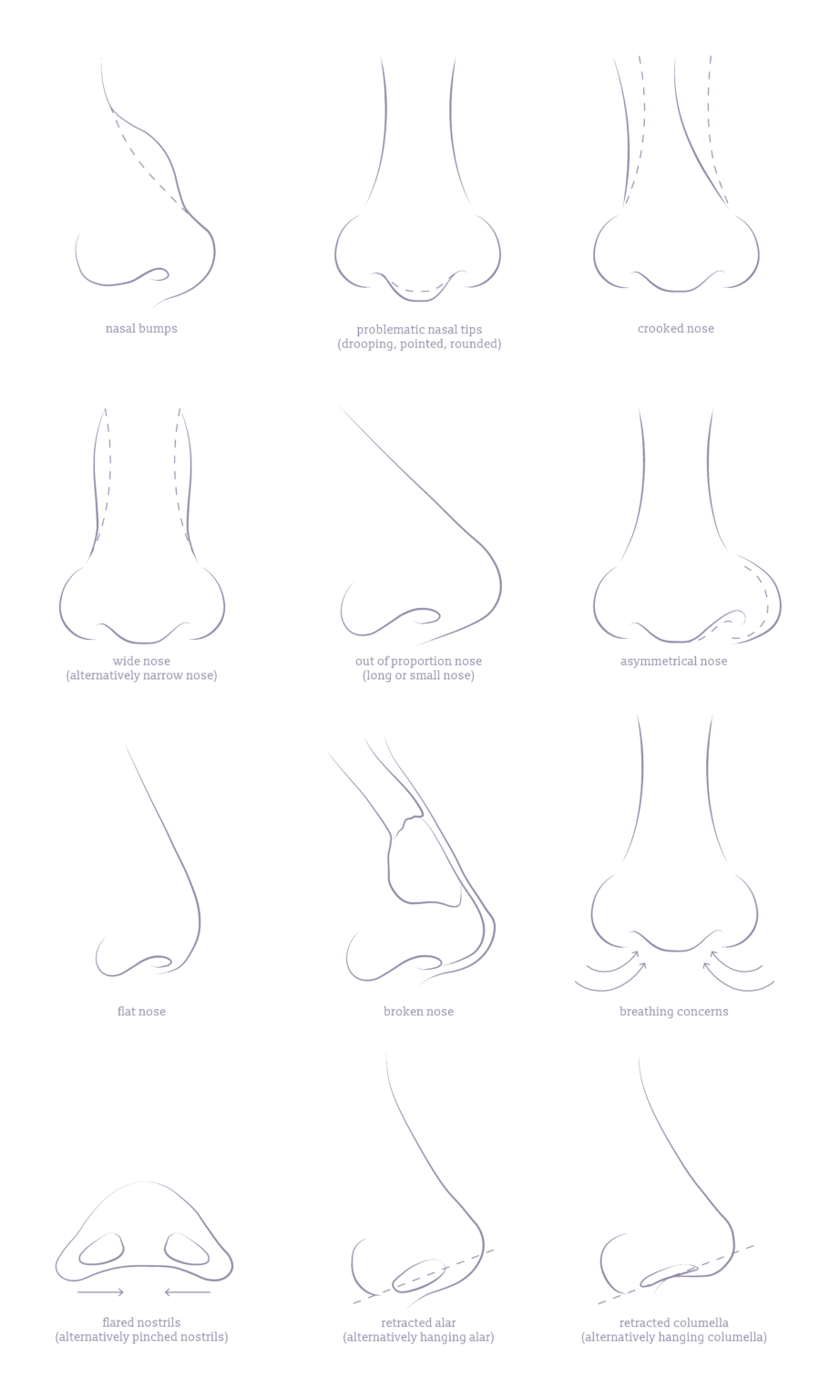 Rhinoplasty Surgery in Melbourne | Nose Job at Me Clinic