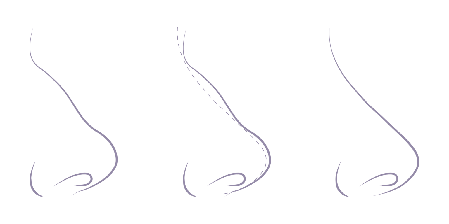 Key Features of a 'Beautiful Nose' - Science Proven | Melbourne