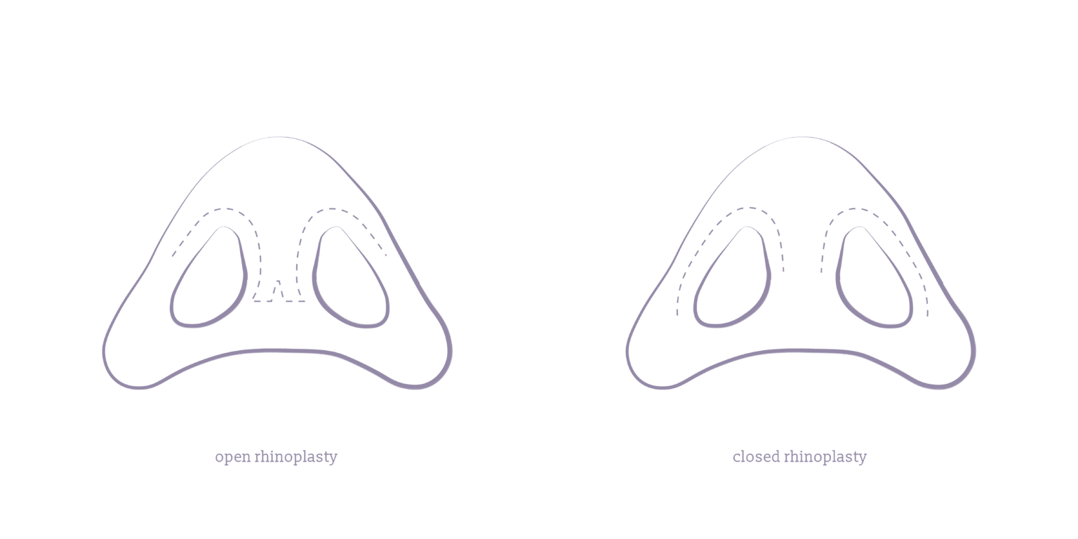 Septoplasty in Melbourne | Deviated Septum Surgery at Me Clinic