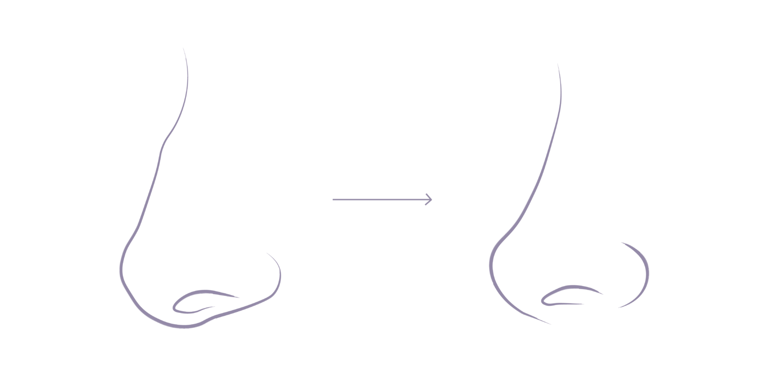 Key Features of a 'Beautiful Nose' - Science Proven | Melbourne