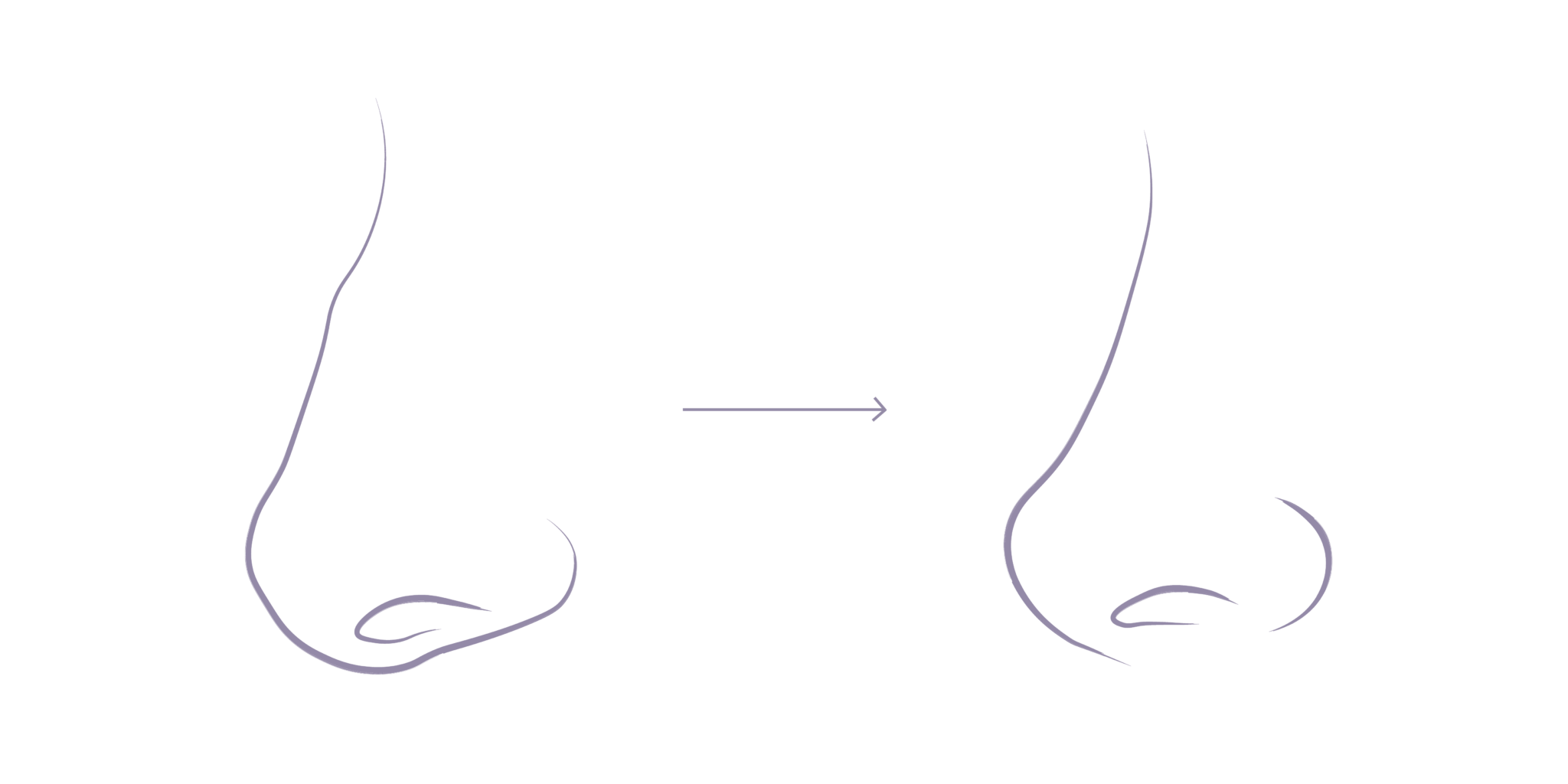 Key Features of a 'Beautiful Nose' - Science Proven | Melbourne