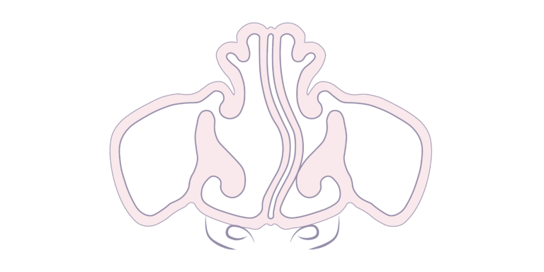 Septoplasty in Melbourne | Deviated Septum Surgery at Me Clinic