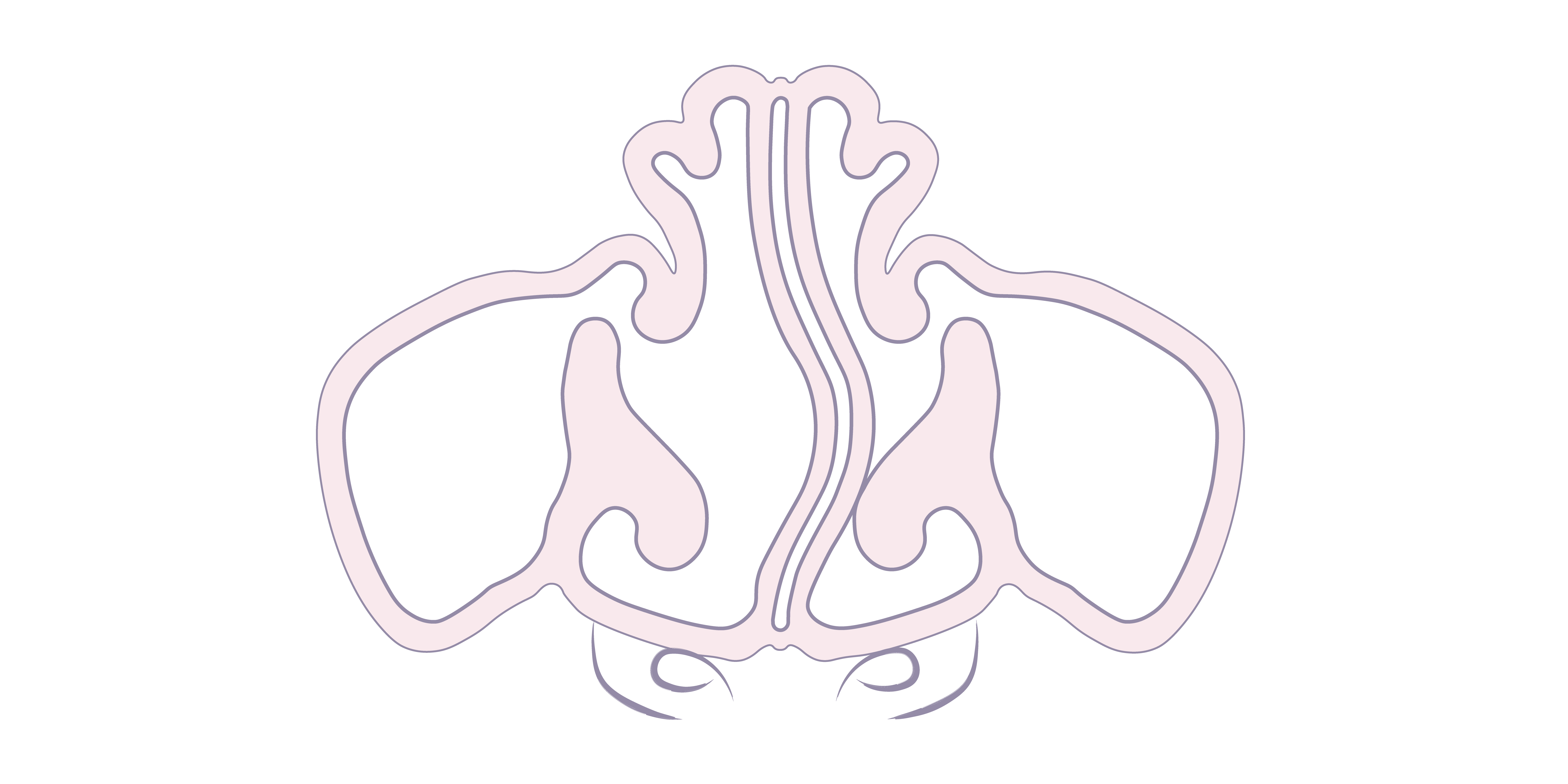 Deviated Septum Diagram
