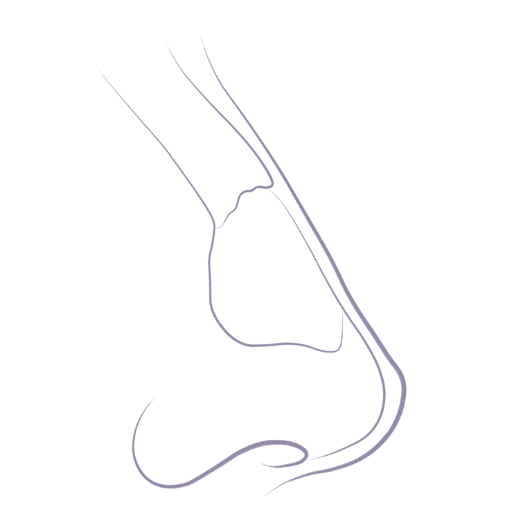 Broken Nose Surgery: What You Need to Know and Do | Me Clinic