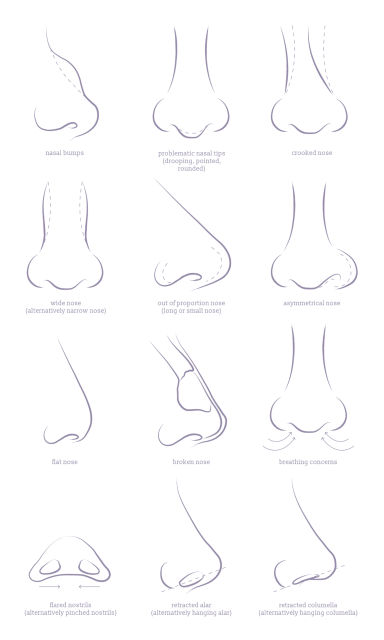 Rhinoplasty Surgery in Melbourne | Nose Job at Me Clinic