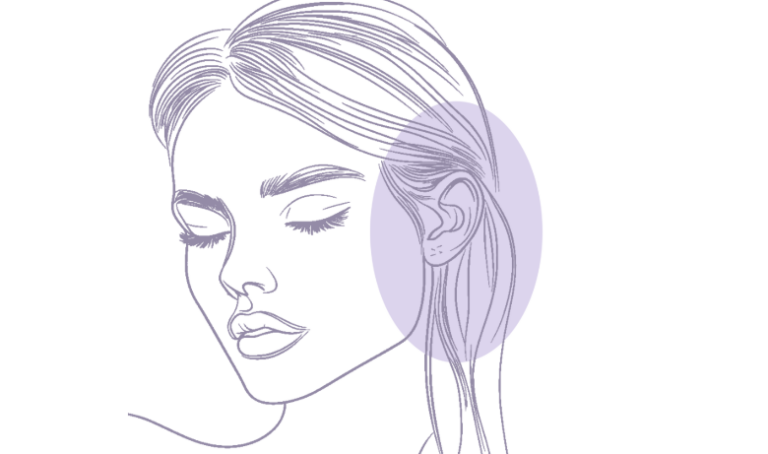 Managing Scars After Otoplasty: Essential Tips for Recovery